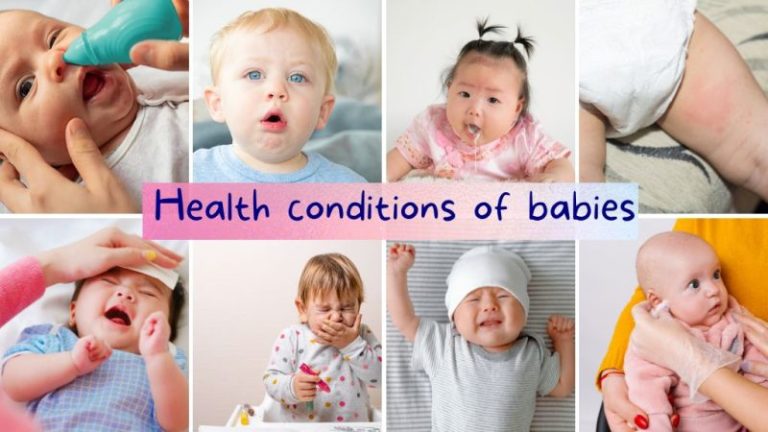 What are the health conditions of babies? - BABY CARE CORNER